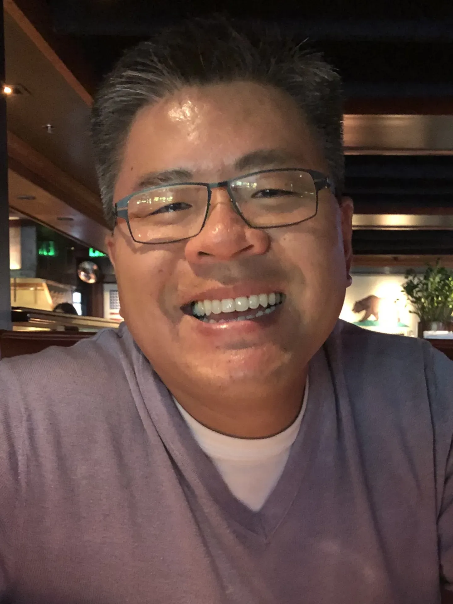 UX a key aspect in Elekta product development | Elekta